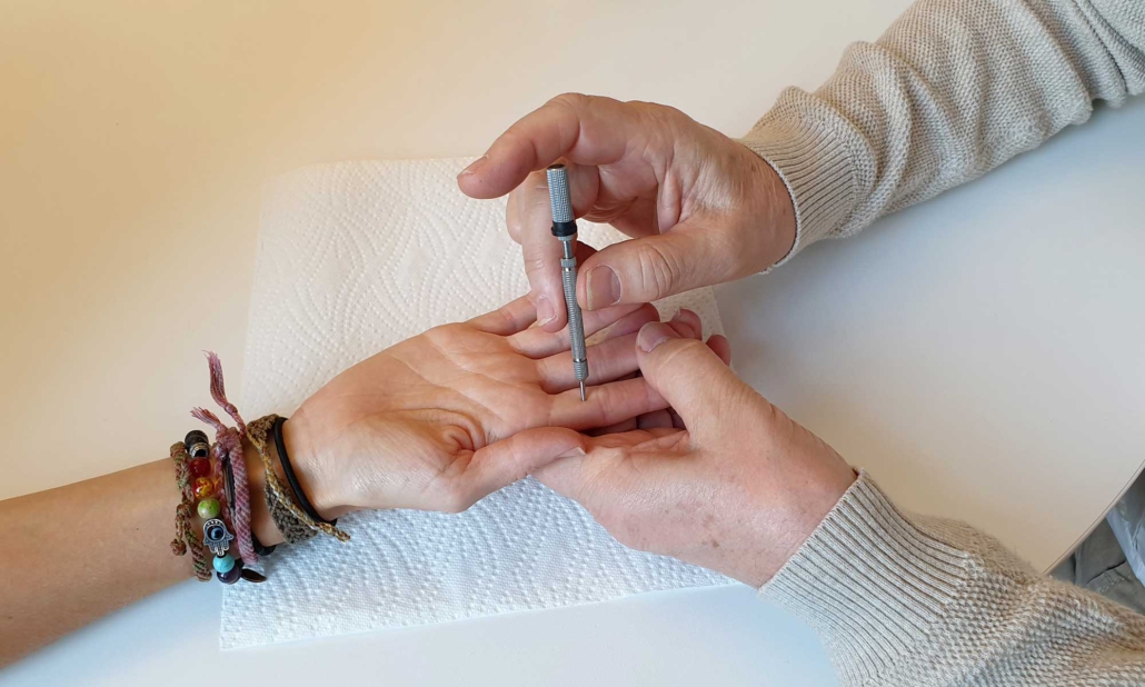 Sujok Therapie – Heilpraktiker Hans Baranek